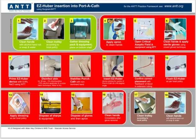 Totally implantable venous access device (TIVAD) or Port-a-Cath policy ...