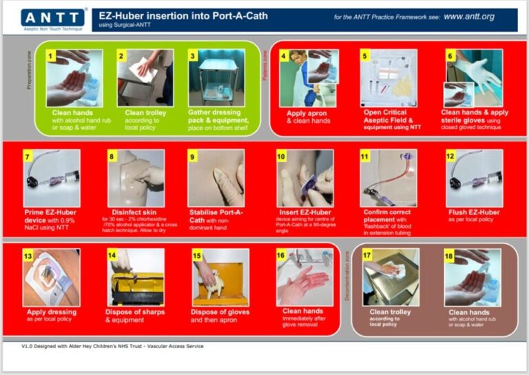 Totally implantable venous access device (TIVAD) or Port-a-Cath policy ...